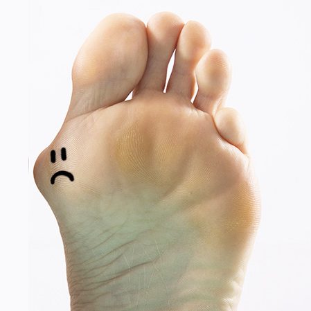Bunions ~ Help For These Bothersome Bumps